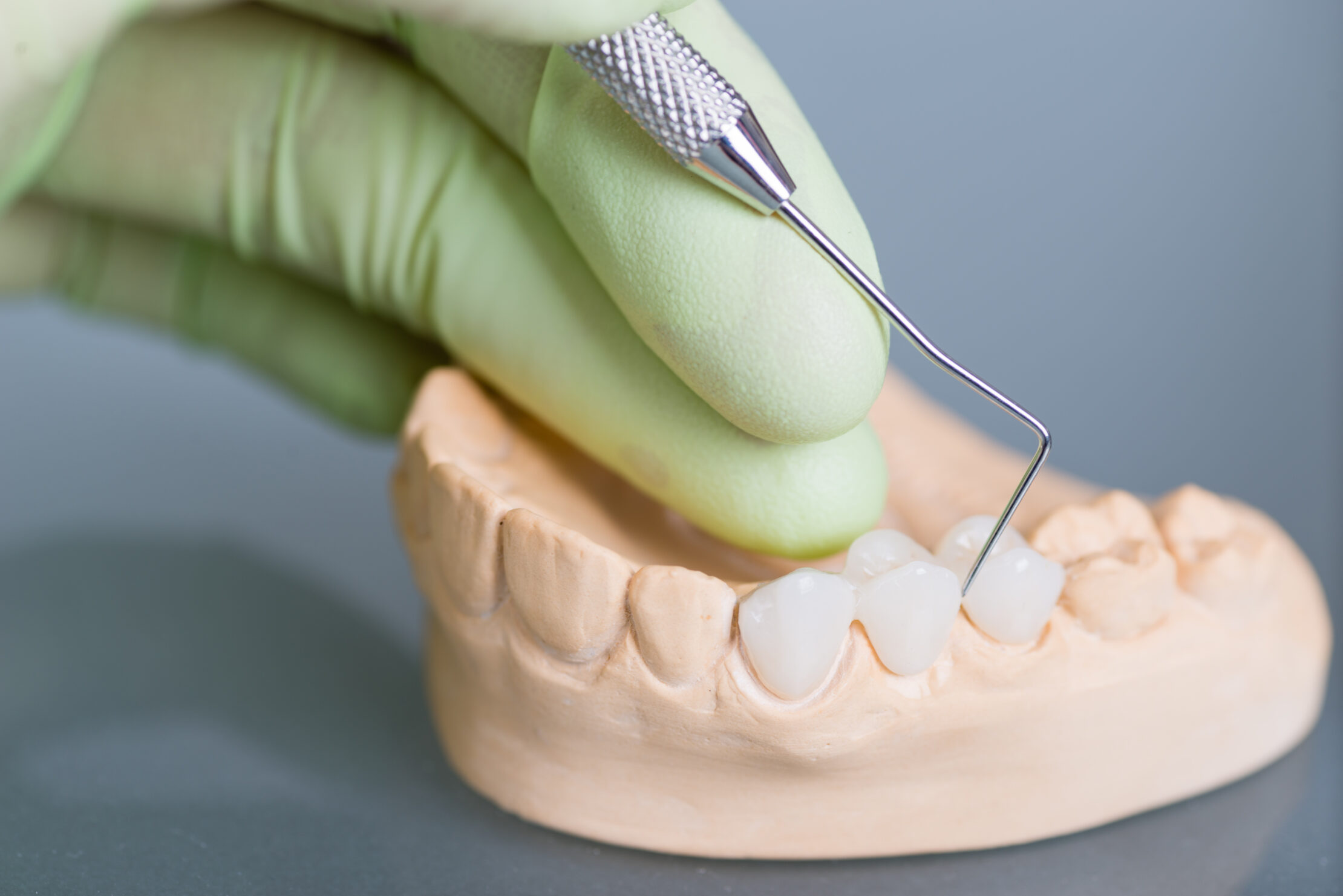 How to Decide if a Dental Bridge is Right For You - Pike & Valega, DDS